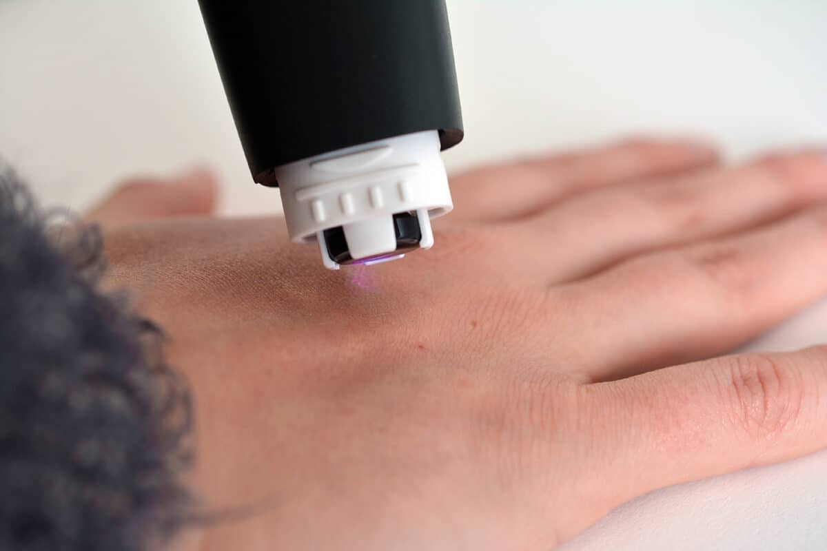 beautyPlas Concept · Plasma technology for cosmetic treatment